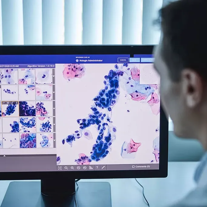 Genius™ Digital Diagnostics System