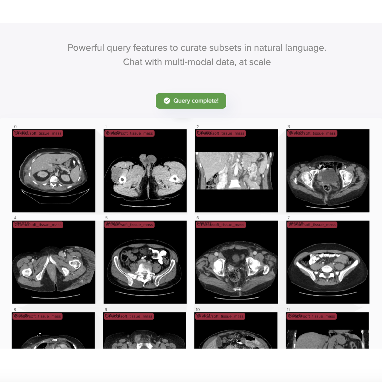 How Bayer Radiology Uses Database for AI to Disrupt Healthcare with GenAI