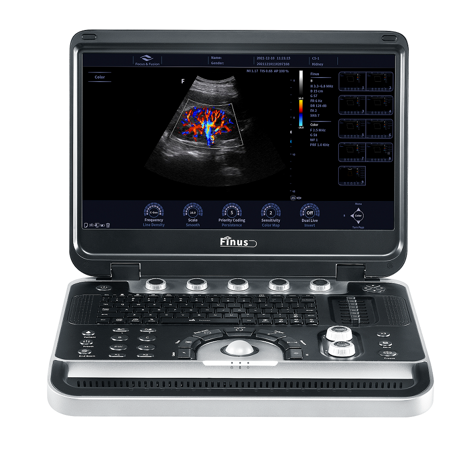 Portable system - Finus 50